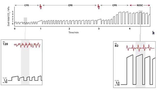 Airway Management Archives - ALS Now