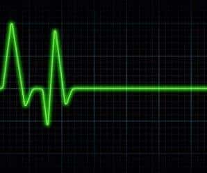 Non-shockable Algorithm (Non VT/VF) - ALS Now